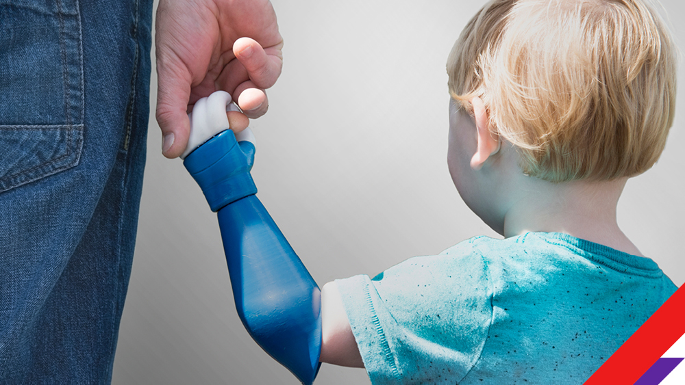 Start-up to help bring bionic limb technology to babies and toddlers ...