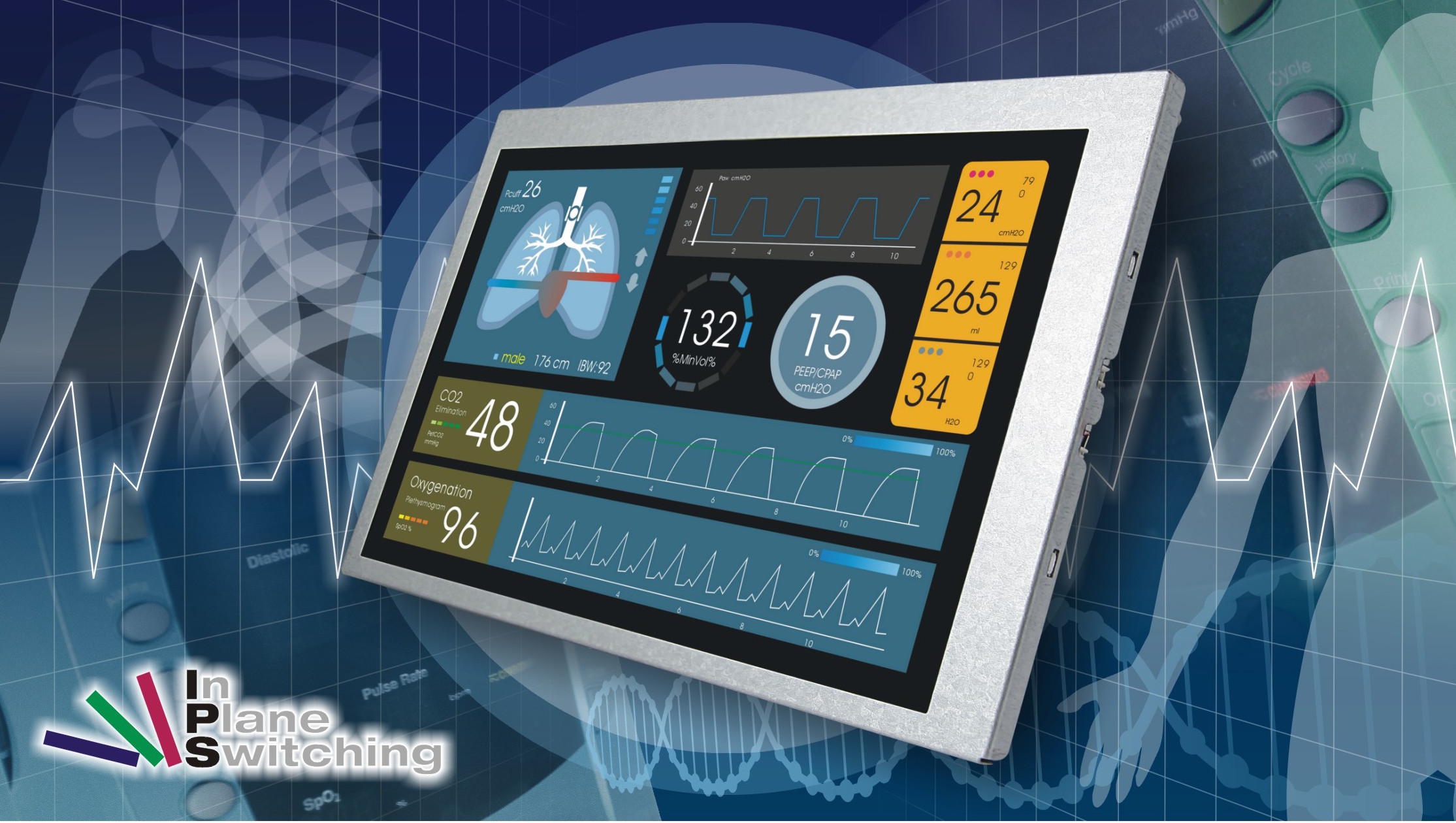 Display solution for use in process control systems - Engineer News Network