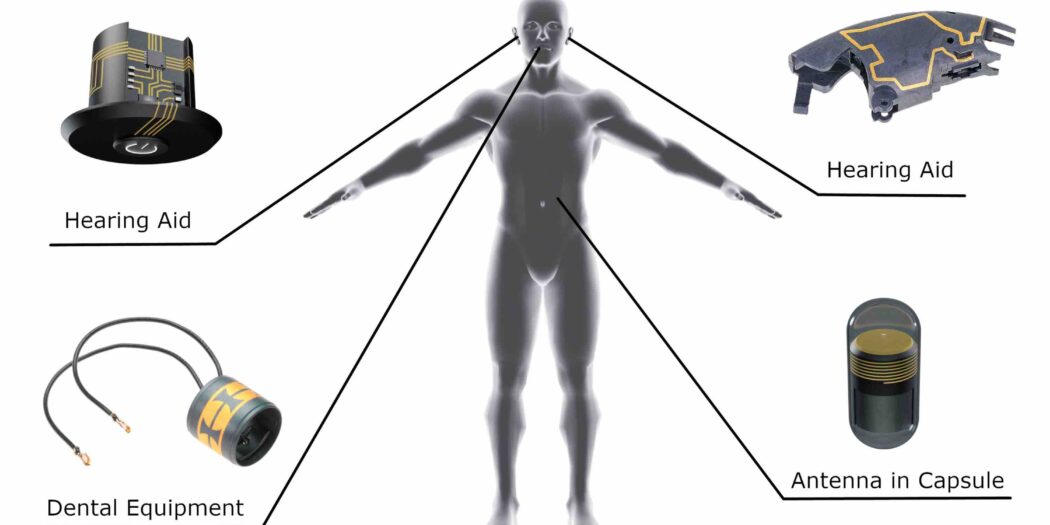 Minimised sensing high-tech within the patient - Engineer News Network